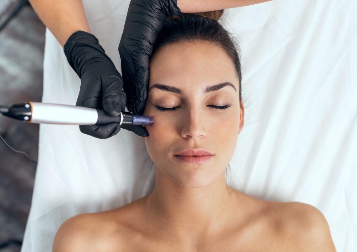 Microneedling: A Revolution in Skin Therapy - Forest Park Wellness